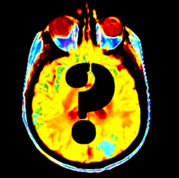 What Should Journalists Look for in an fMRI Research Paper - NeuroRelay